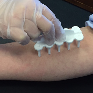 Allergy Skin Test | Certified Allergy & Asthma Consultants